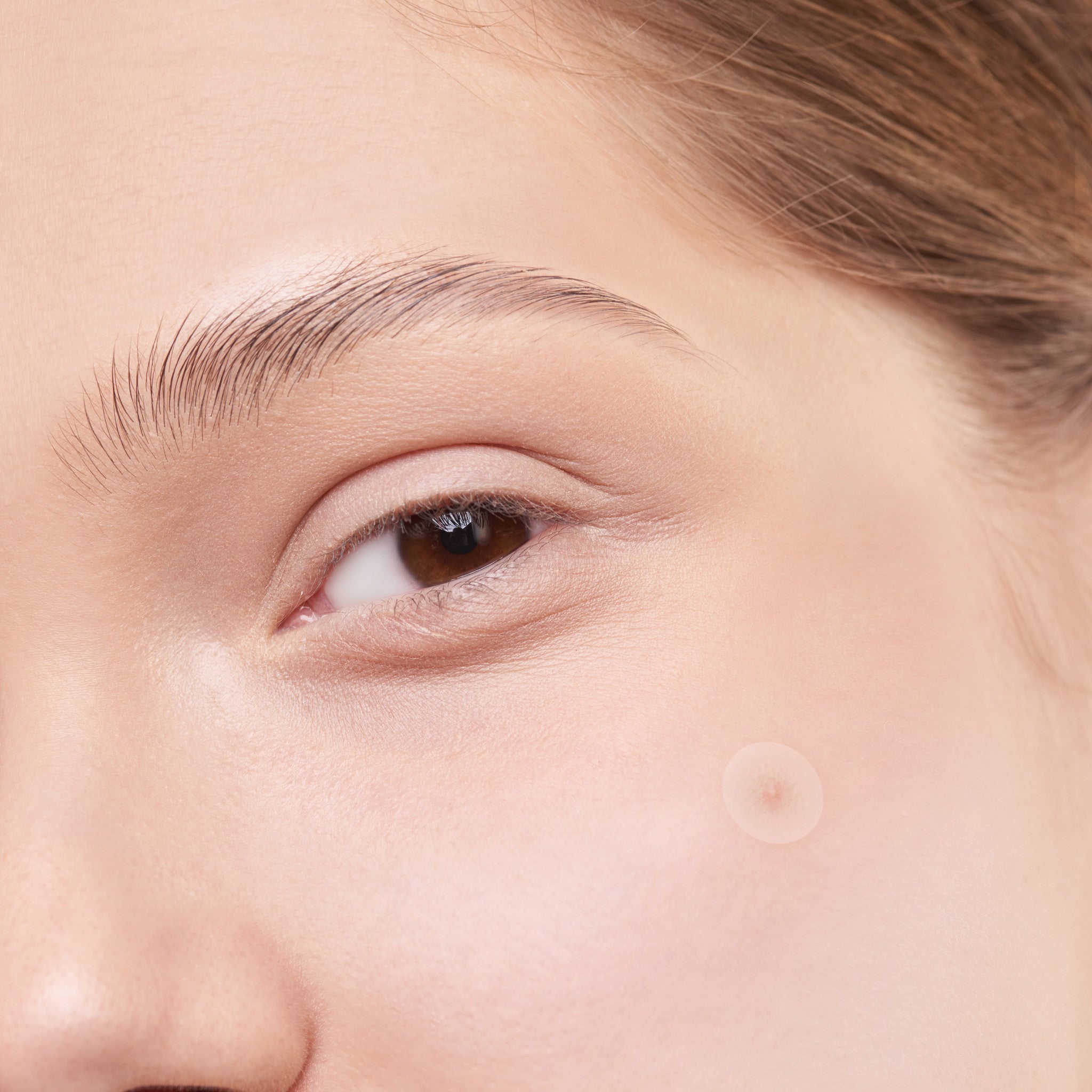 Pimple Patches | Sensitive skin - Girls Matters Period Underwear